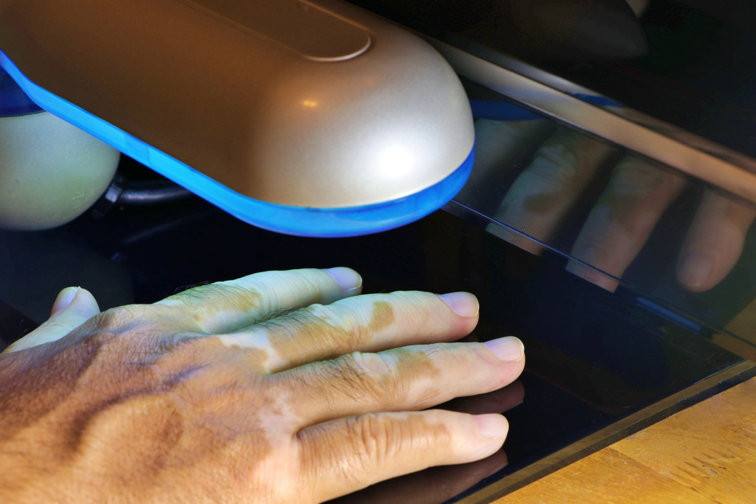 Everything you need to know about the use of phototherapy for treating ...