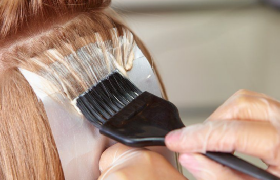 Is It Safe To Dye Your Hair When You Have Vitiligo The Vitiligo Society is-it-safe-to-dye-your-hair-when-you-have-vitiligo-the-vitiligo-society