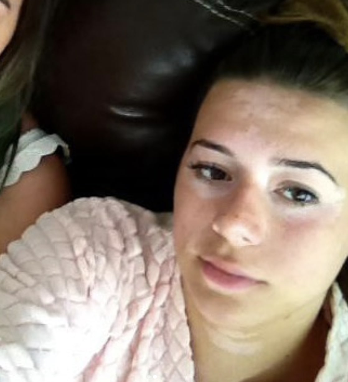 Demi Sims shares how her self-confidence was affected by her vitiligo ...