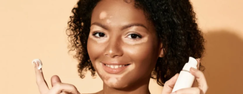 Top Tips for Choosing Vitiligo-Friendly Coverage Products - The ...